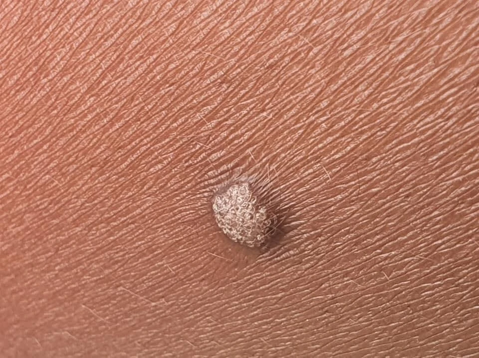 L'actualité indépendante de référence en Côte d'Ivoire | Linfodrome